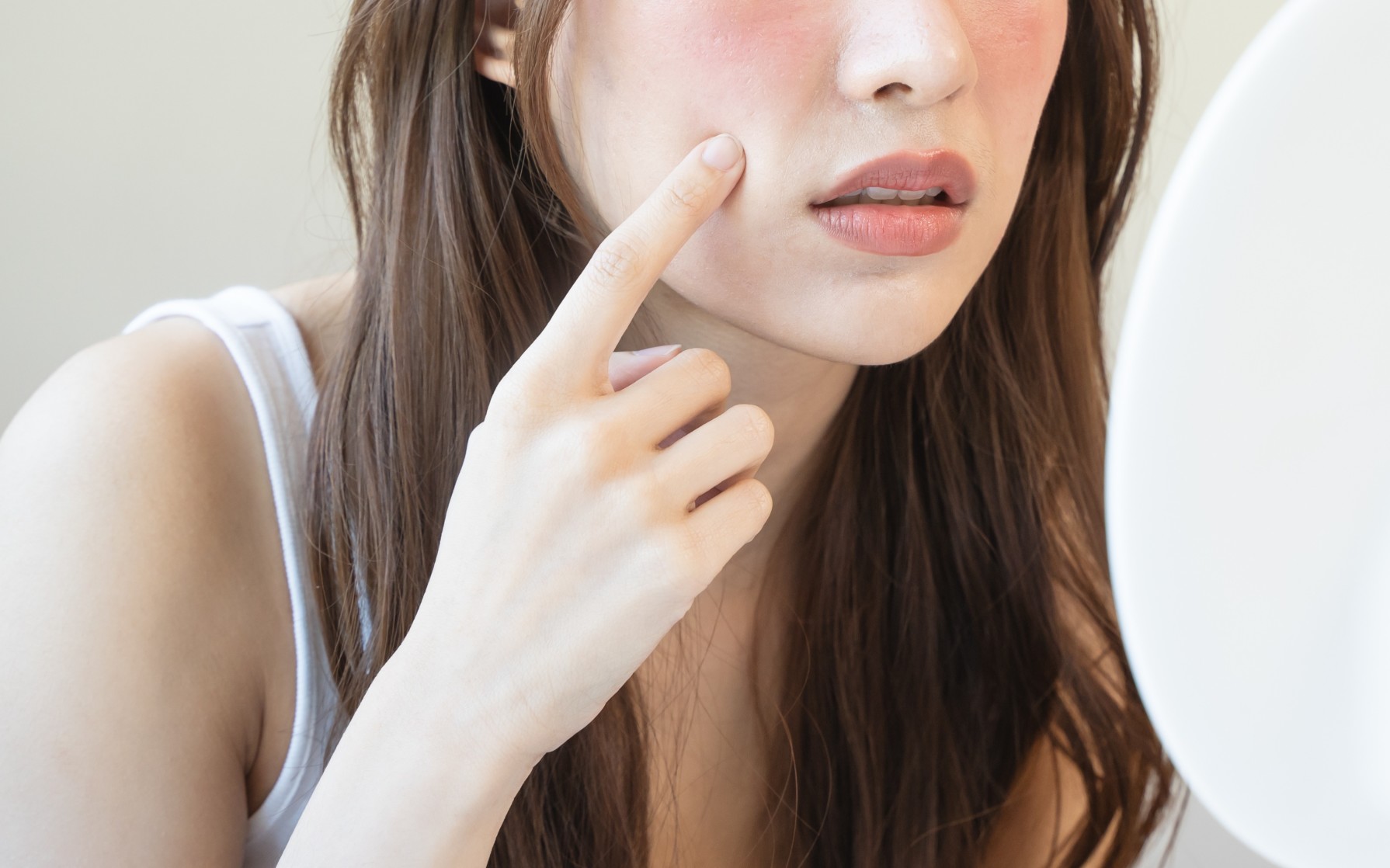 Rougeurs à cause du froid : les causes et les solutions - Aroma-Zone